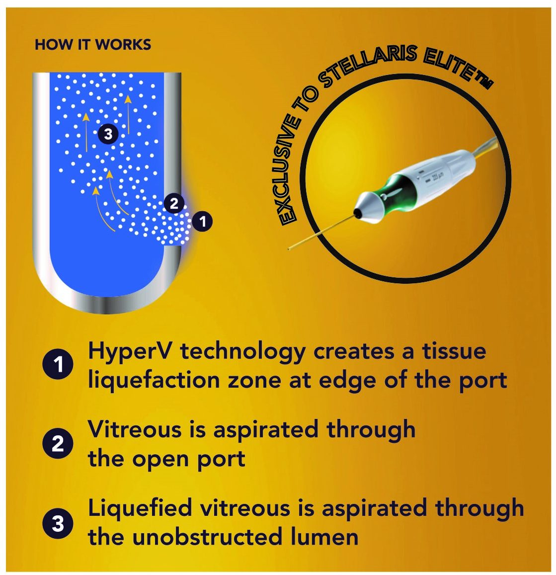 Stellaris Elite (Posterior - Combined Model) | PT. Global Selaras Medika